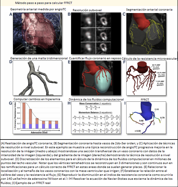 Reserva de flujo fraccional por angiotomografía coronaria (ffrct) ¿Cambio de paradigma o solo ...